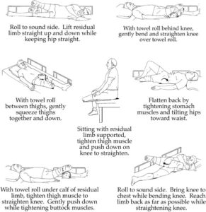 Exercises – Sola Prosthetics